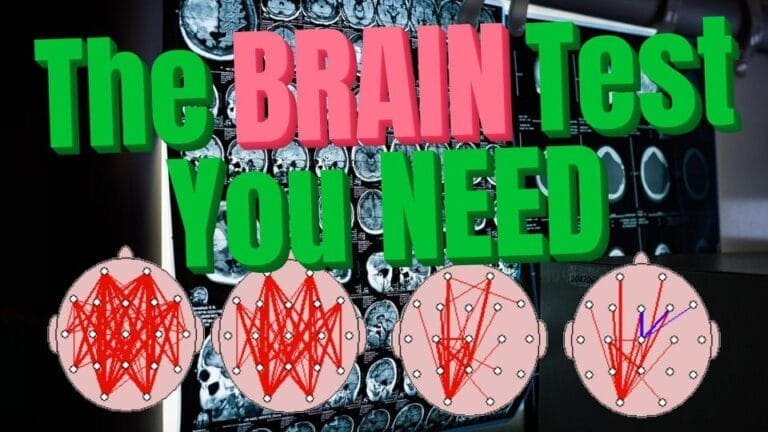 qEEG Brain Mapping: Discover What Other Tests Miss